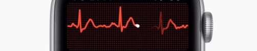 Apple and Atrial Fibrillation | MEDICALTECH.CA